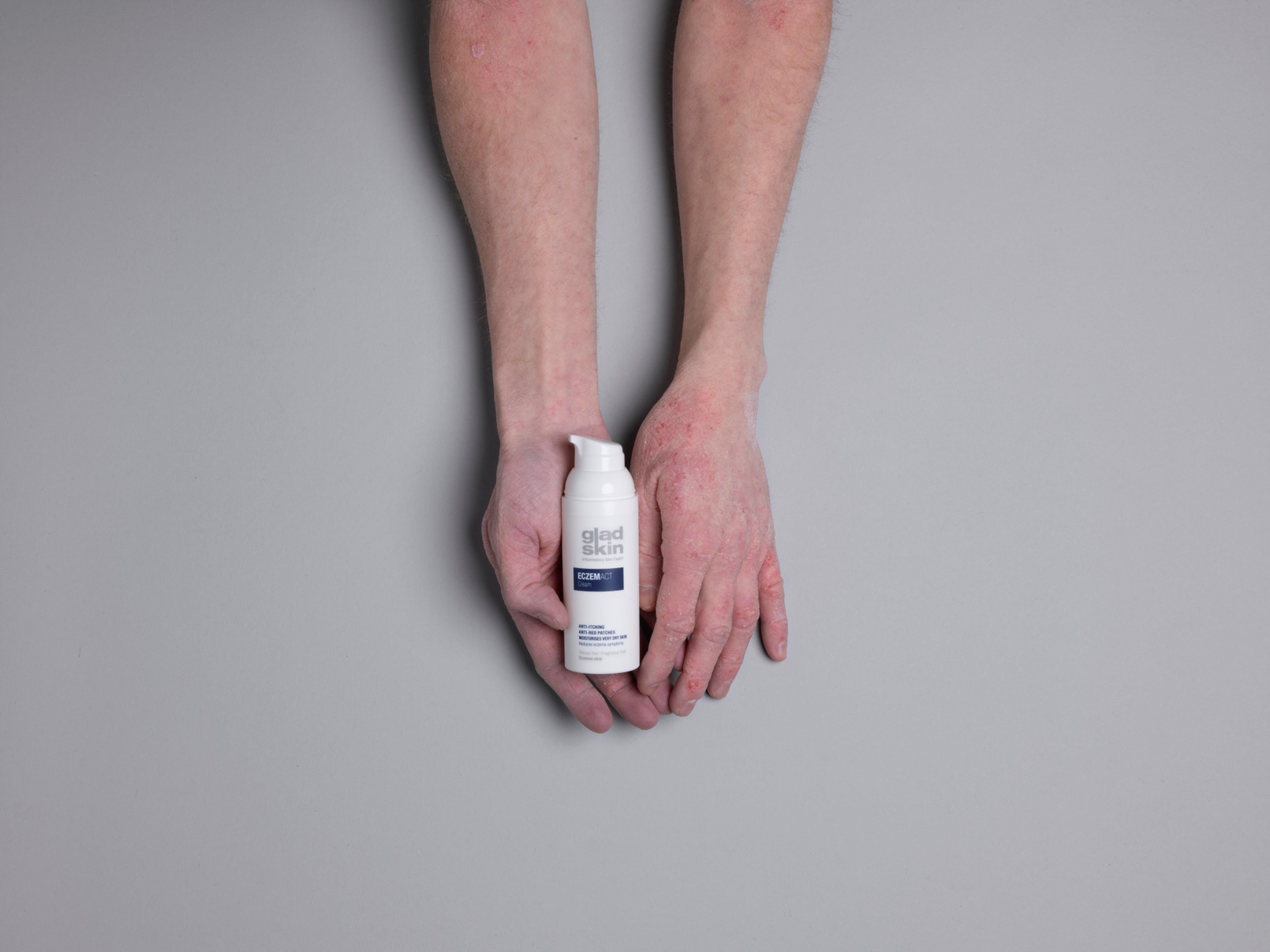 Eczemact Cream | Vermindert eczeem symptomen | Gladskin